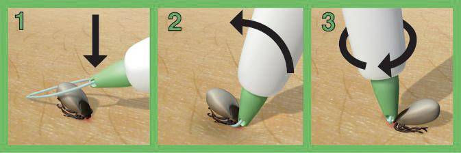 Buy 3iX tick sling Tick lasso remover White 1 pc(s) | Conrad Electronic